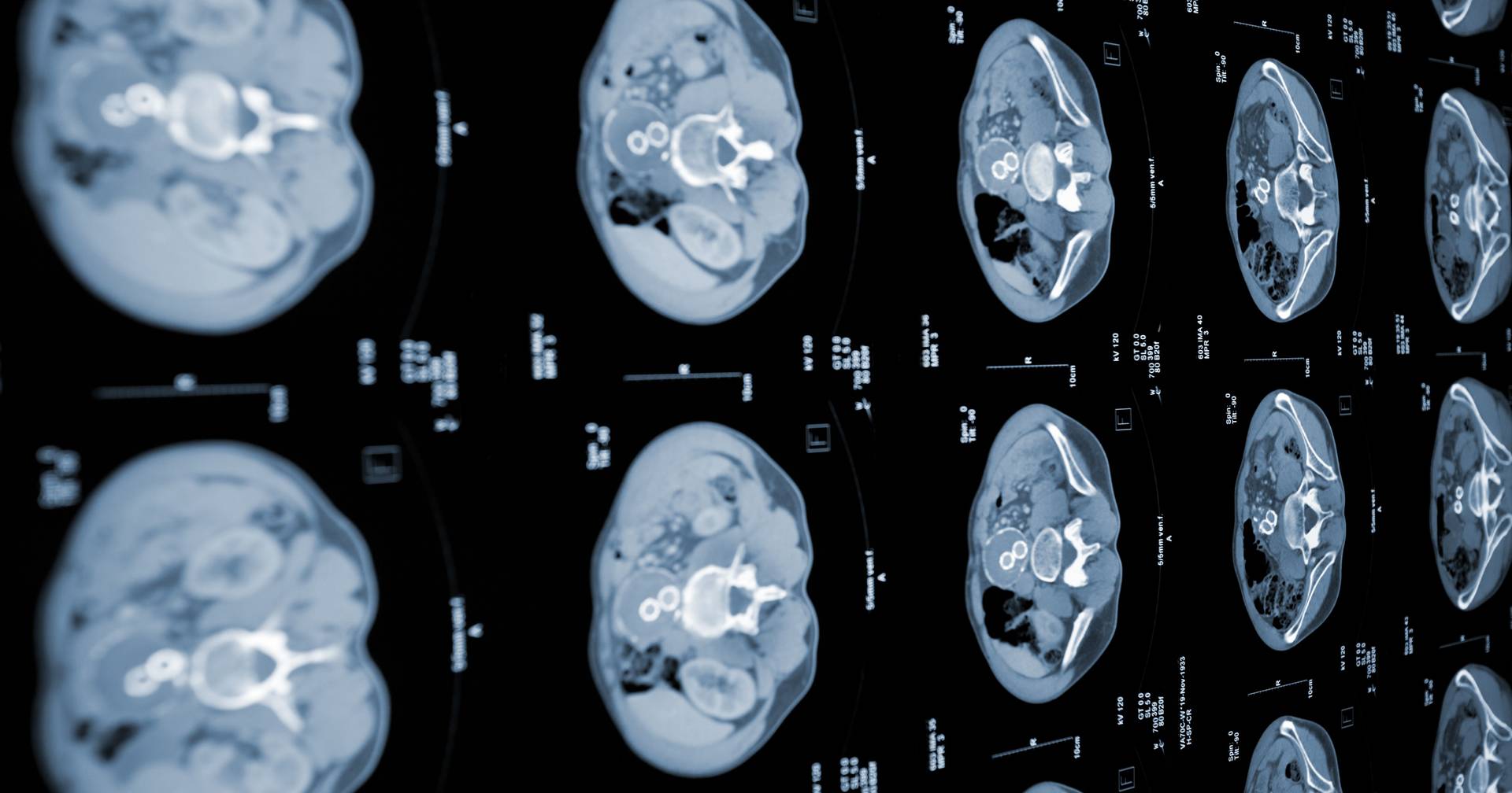 Cientistas identificam biomarcador para melhorar eficácia de tratamento ...