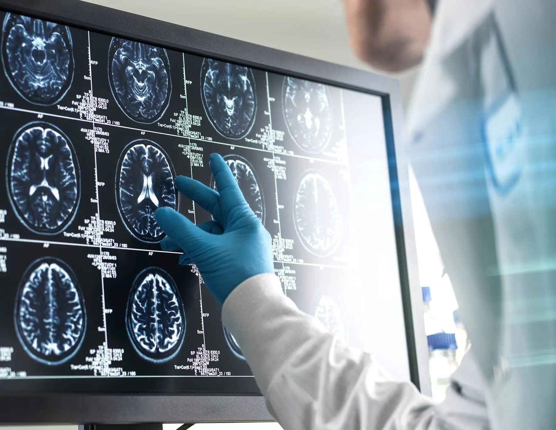 Desigualdade provoca lesões no cérebro e diminui a capacidade cognitiva ...