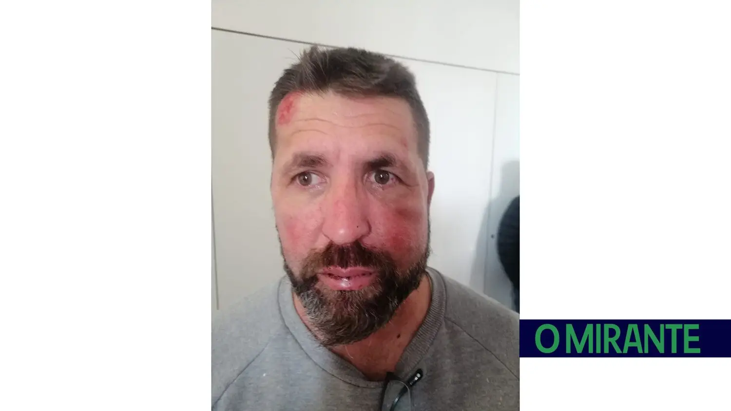 O Mirante Vasco Filipe Diz Que Foi Agredido Com Violência Por Militar