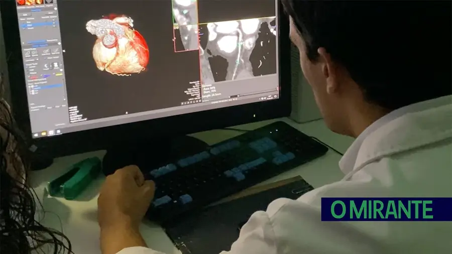 O MIRANTE | Hospital de VFX realiza primeiro AngioTAC cardíaco