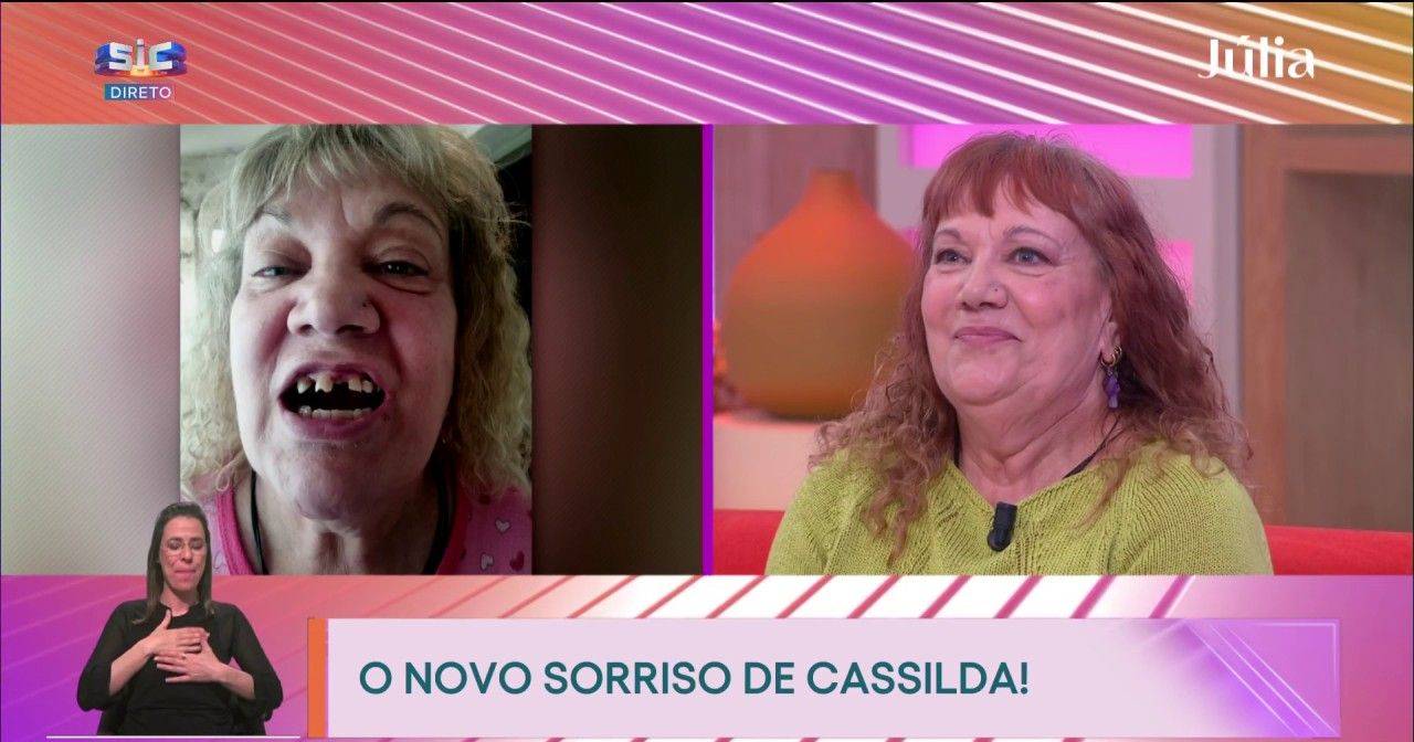 A transformação do sorriso de Cassilda: "Estou muito feliz!" - SIC