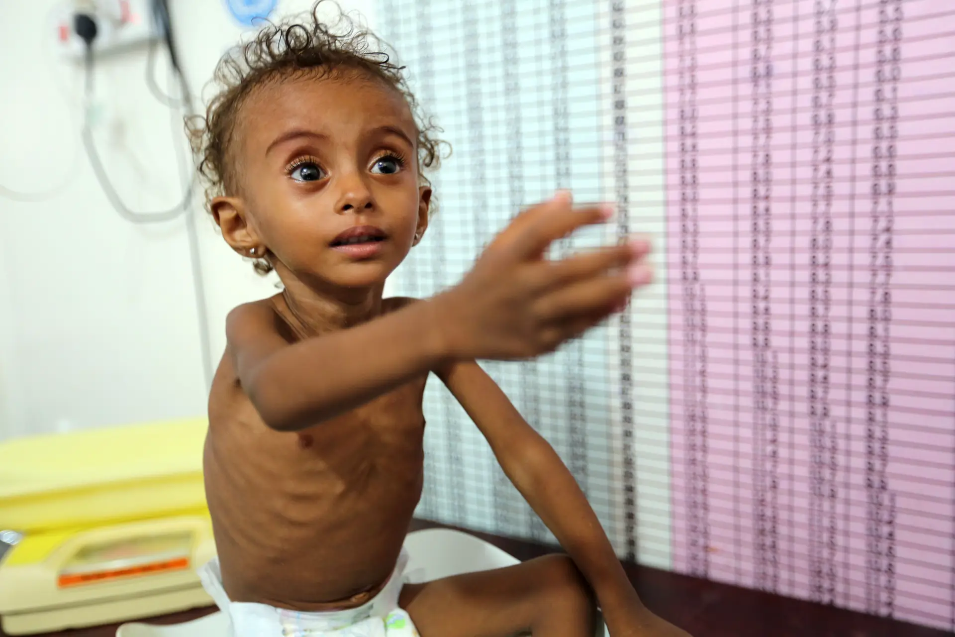 Cerca De 85 Mil Crianças Morreram De Fome No Iémen Em 3 Anos Sic Notícias