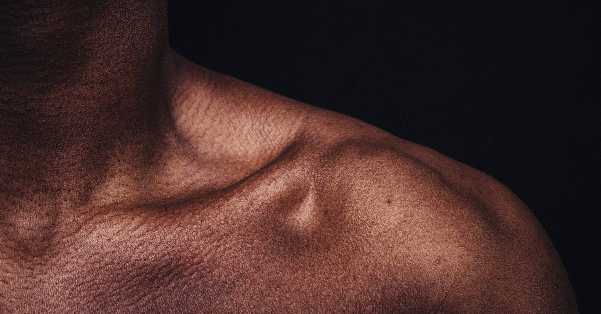 Tenho Cancro. E depois | Melanoma. Saiba o que é e como pode preveni-lo Tenho Cancro. E depois | Melanoma. Saiba o que é e como pode preveni-lo
