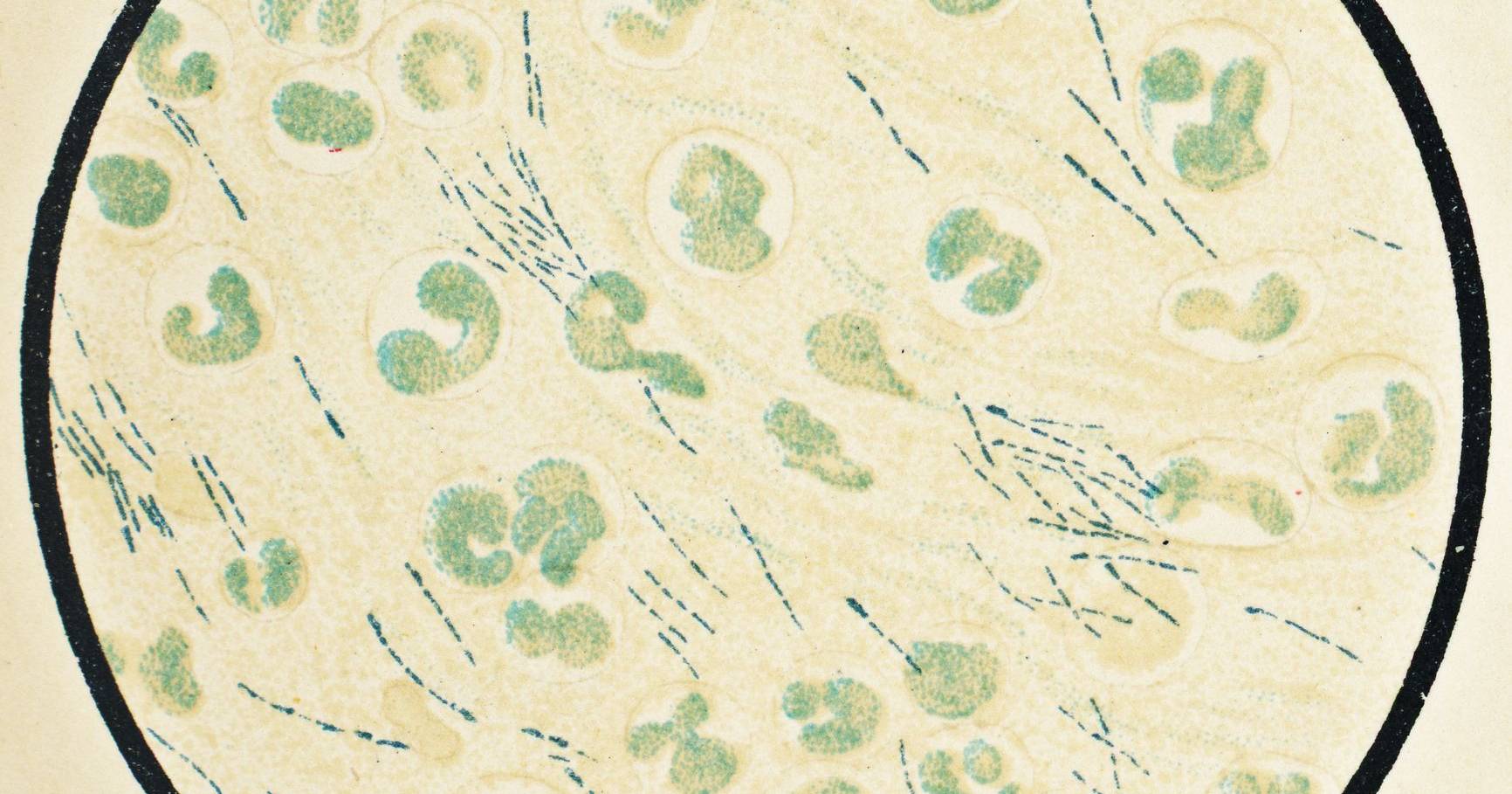 Bactérias causadoras de doenças infecciosas graves detetadas nos EUA ...