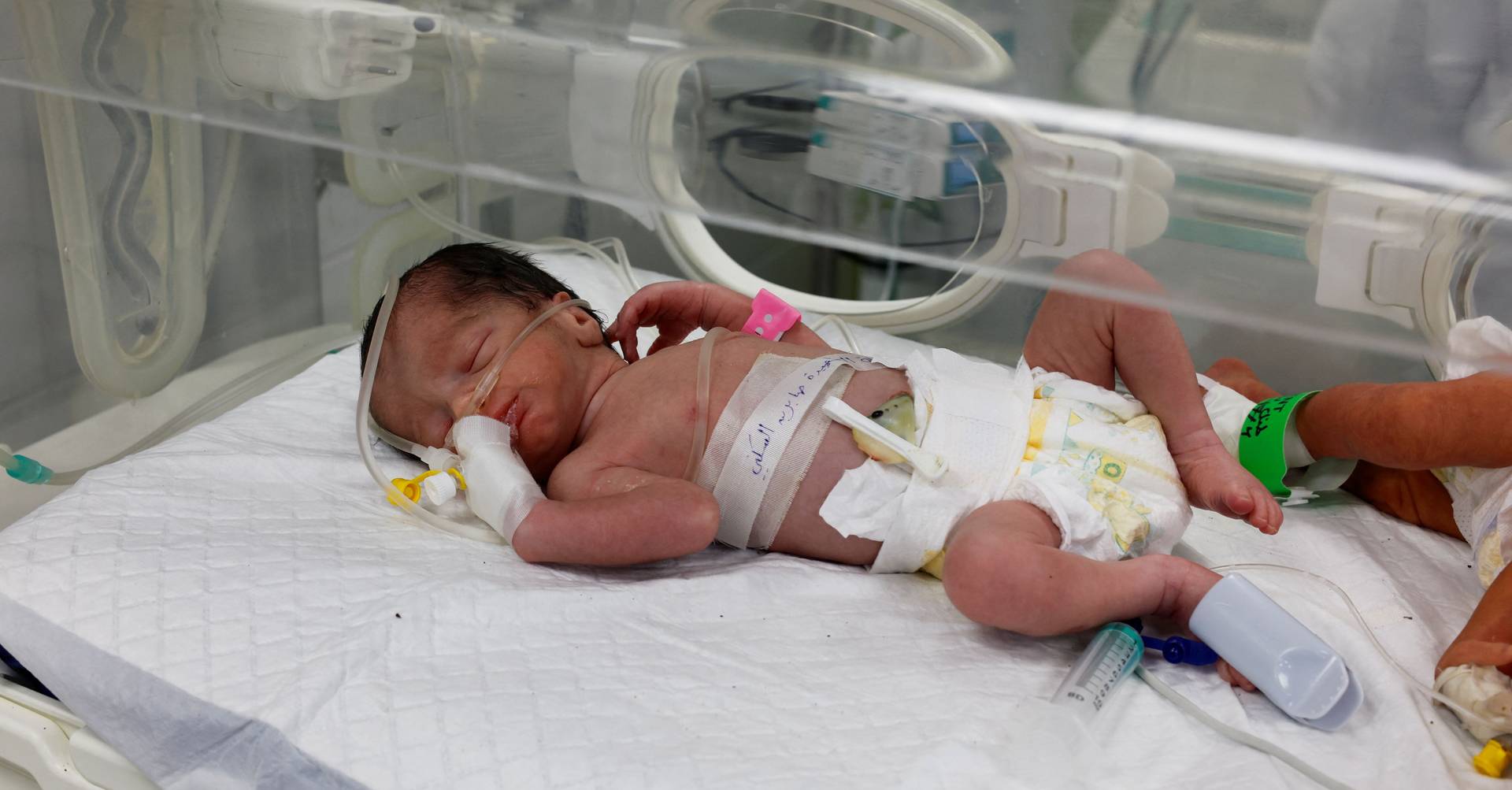 "Bebé-martir" nasce em Gaza pouco depois da morte da mãe - SIC Notícias