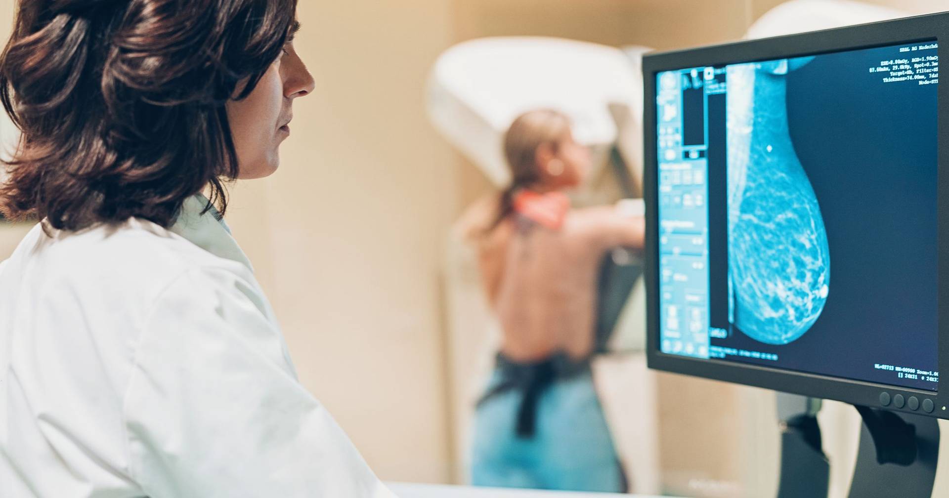 Rastreio Do Cancro Da Mama “se Tem Entre 45 E 74 Anos Responda Ao 9057