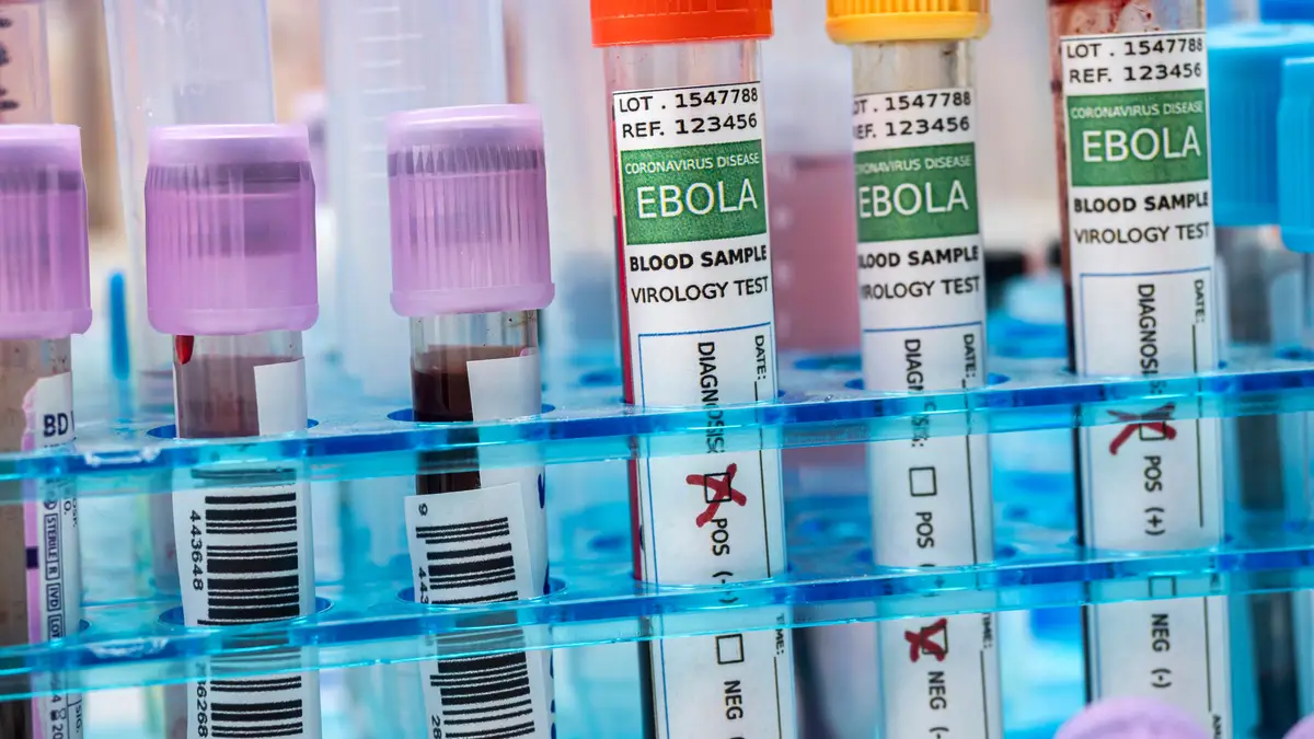 RD Congo sem meios para travar surto de ébola que já fez mais de 130 ...